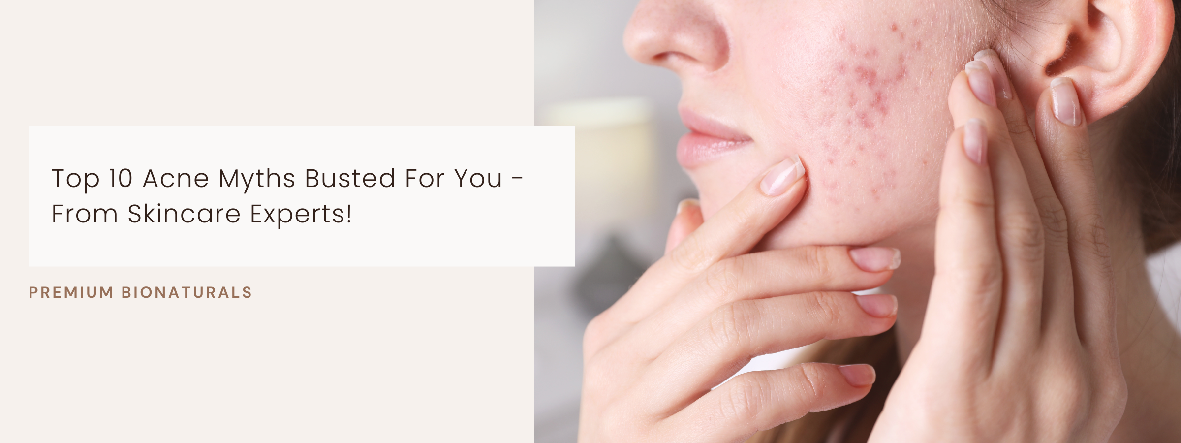 Top 10 Acne Myths Busted For You - From Skincare Experts! – Premium ...