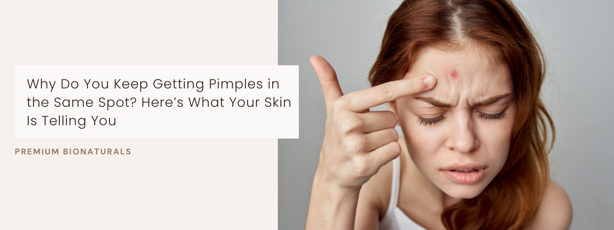 Why Do You Keep Getting Pimples in the Same Spot? Here’s What Your Ski ...